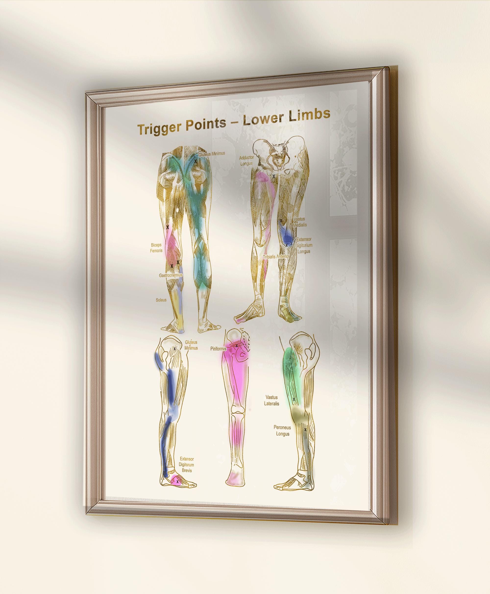 Trigger Points Charts Bundle – Digital Download Anatomy Poster Set for ...