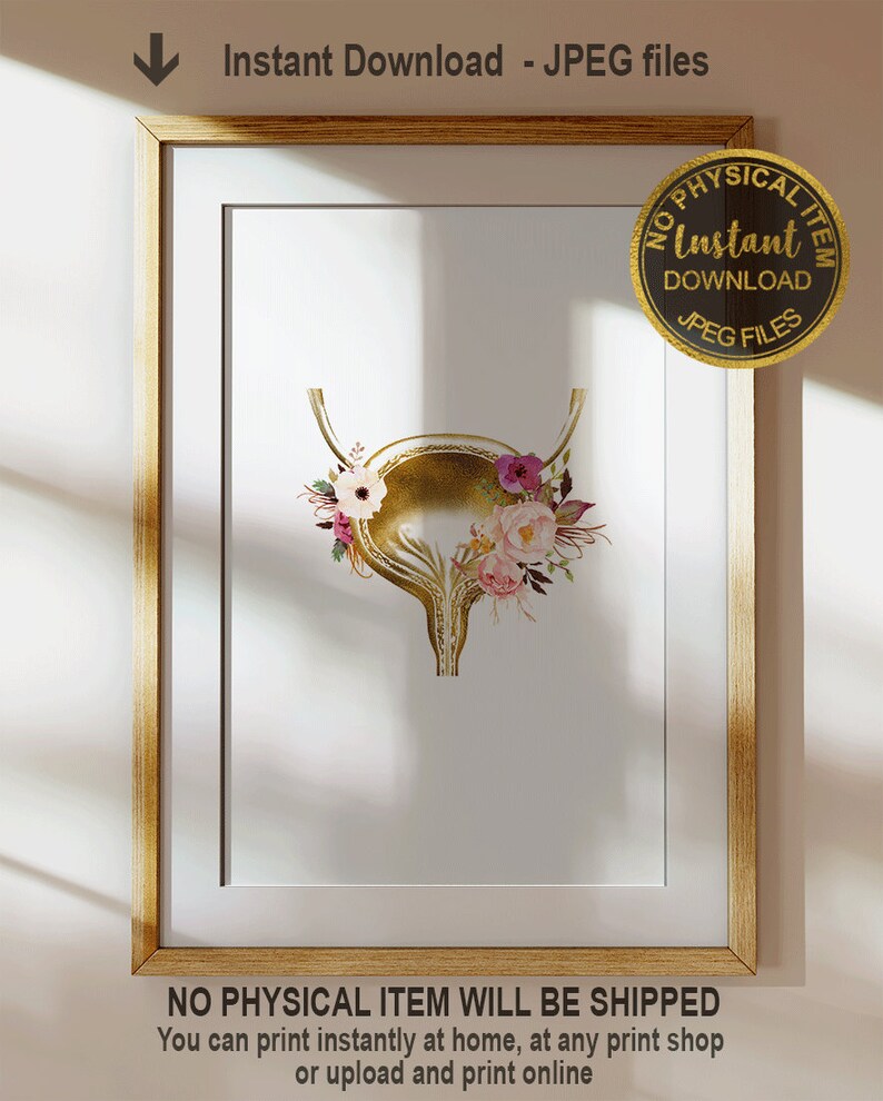 Bladder Art Print Urinary System Print Urology Clinic Decor - Etsy India