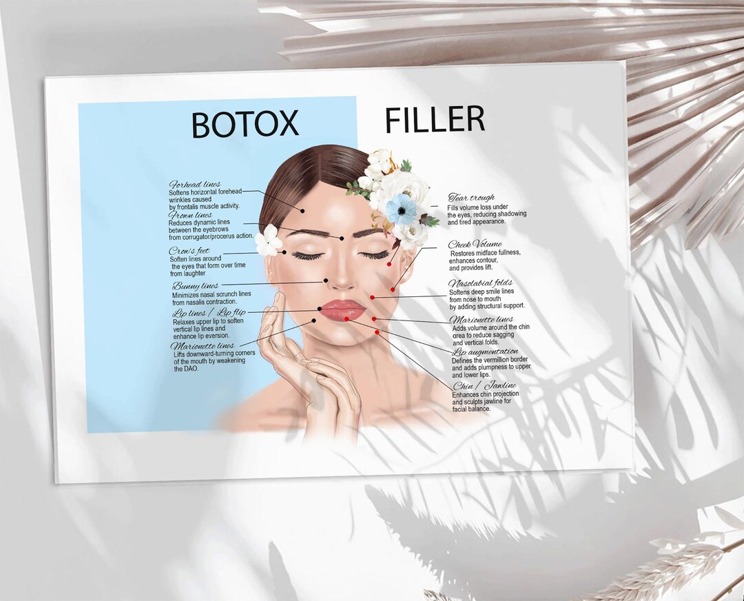 Botox Vs Filler Aesthetic Anatomy Poster | Facial Injection Guide Print ...
