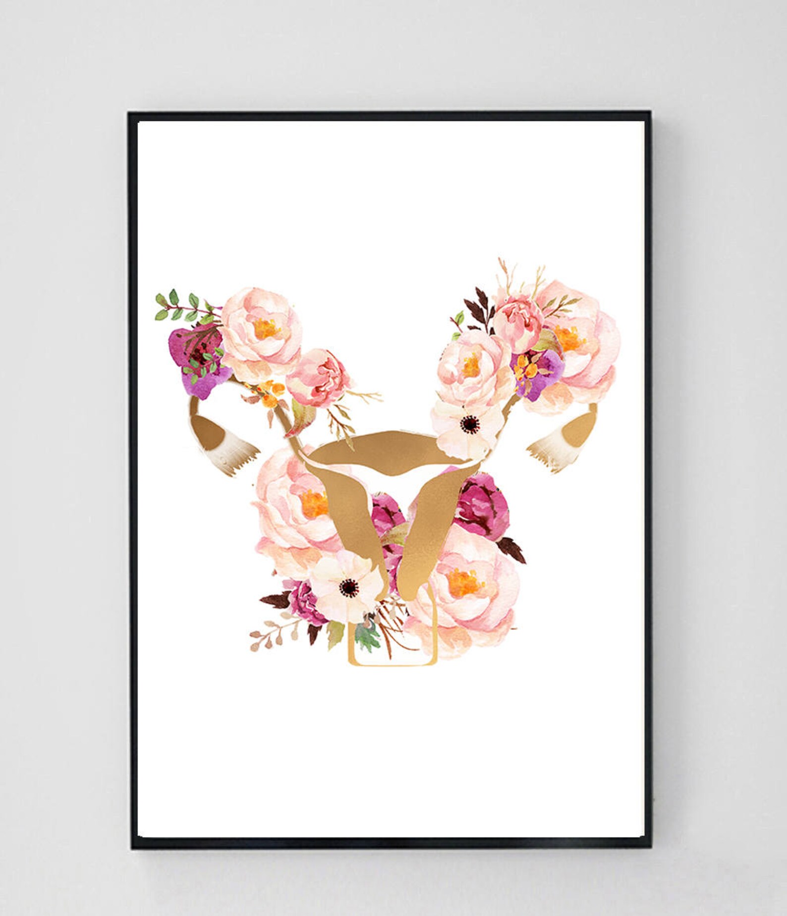Anatomy Art Poster Uterus Art Gynecology Print Doctor Office - Etsy