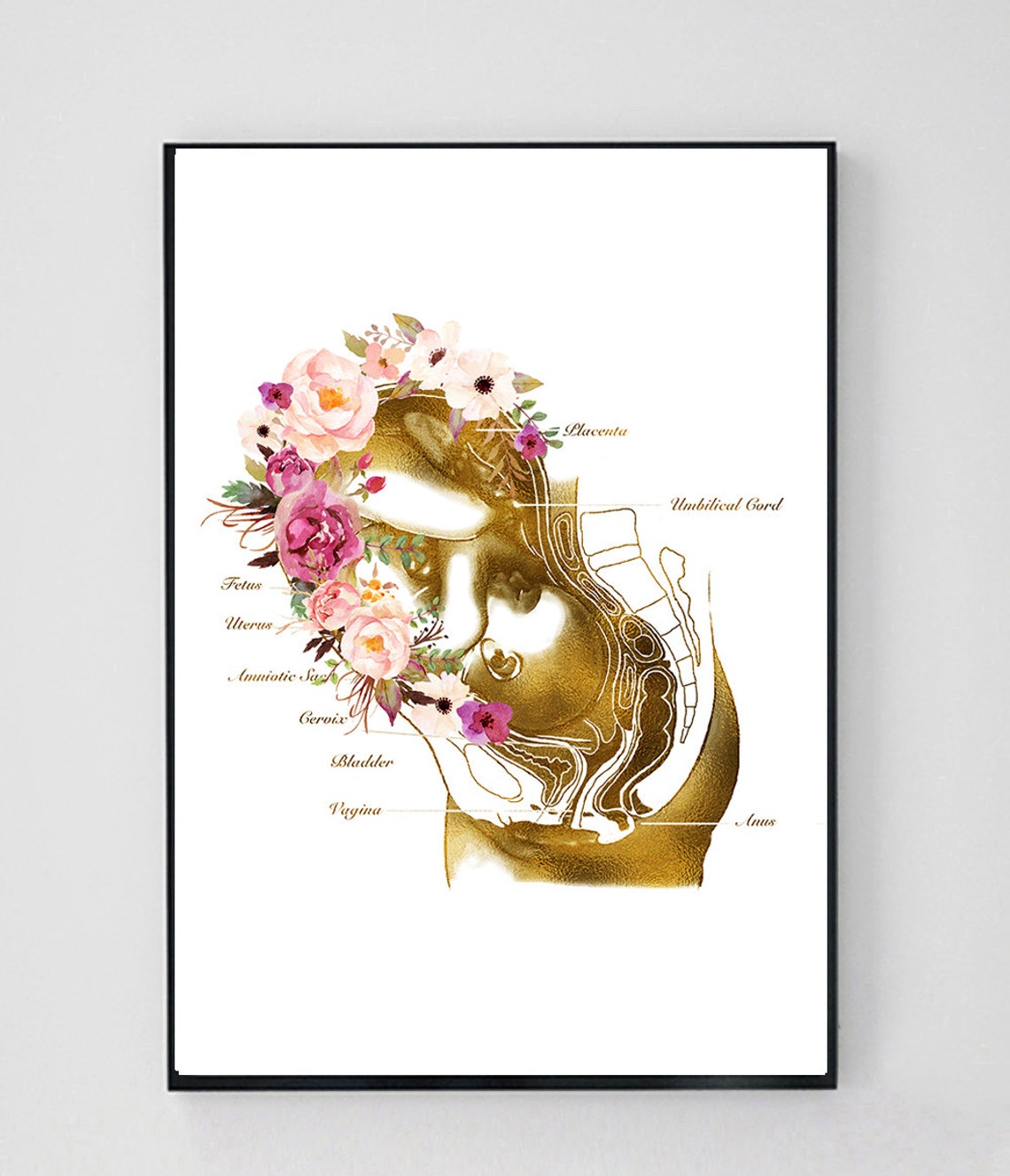 Pregnancy Print Midwife Gift Obstetric Art Gynecology - Etsy