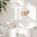Pancreas Anatomy Art, Medical Office Decor, Hepatology ...