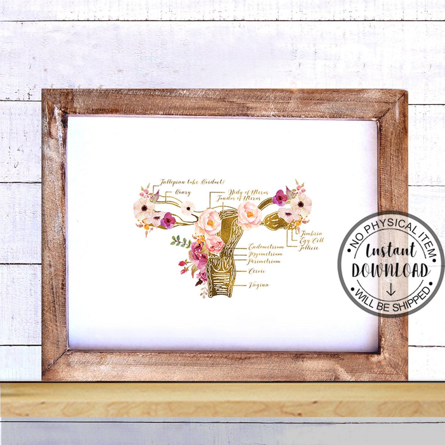 Obgyn Gift Uterus Anatomy Art Uterus Art Print Gynecologist | Etsy ...