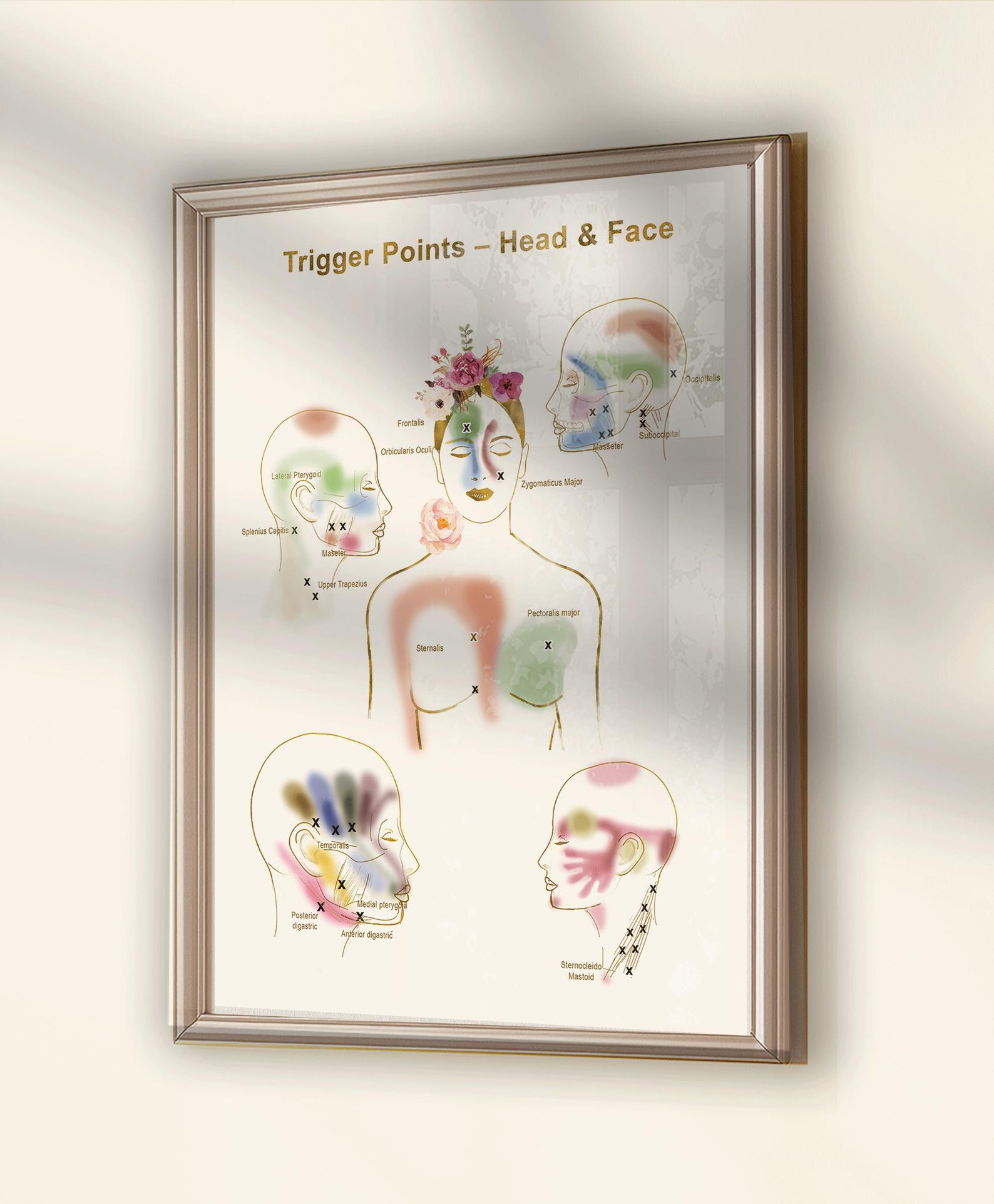 Trigger Points Charts Bundle – Digital Download Anatomy Poster Set for ...
