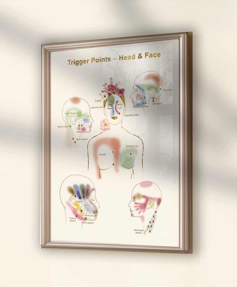 Trigger Points Charts Bundle – Digital Download Anatomy Poster Set for ...