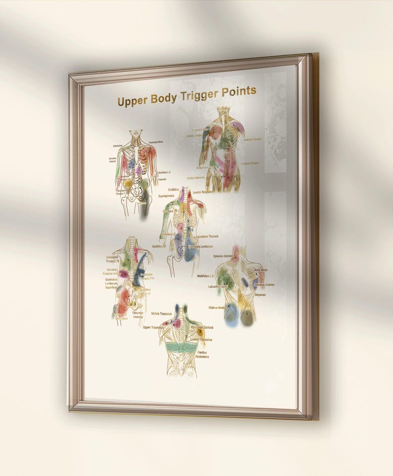 Trigger Points Charts Bundle – Digital Download Anatomy Poster Set for ...