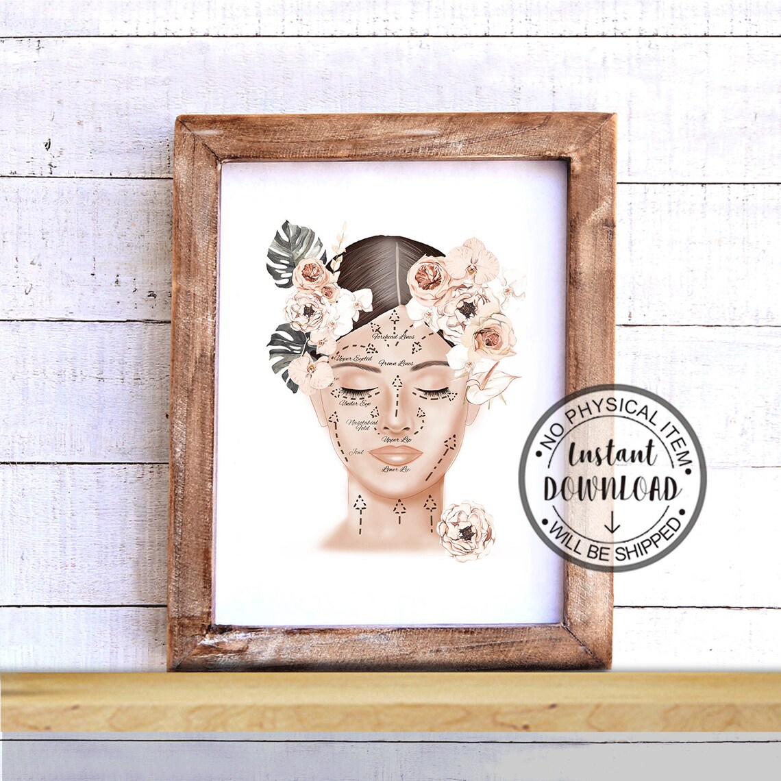 Dermal Fillers Face Map Art Cosmetic Art Plastic Surgeon - Etsy