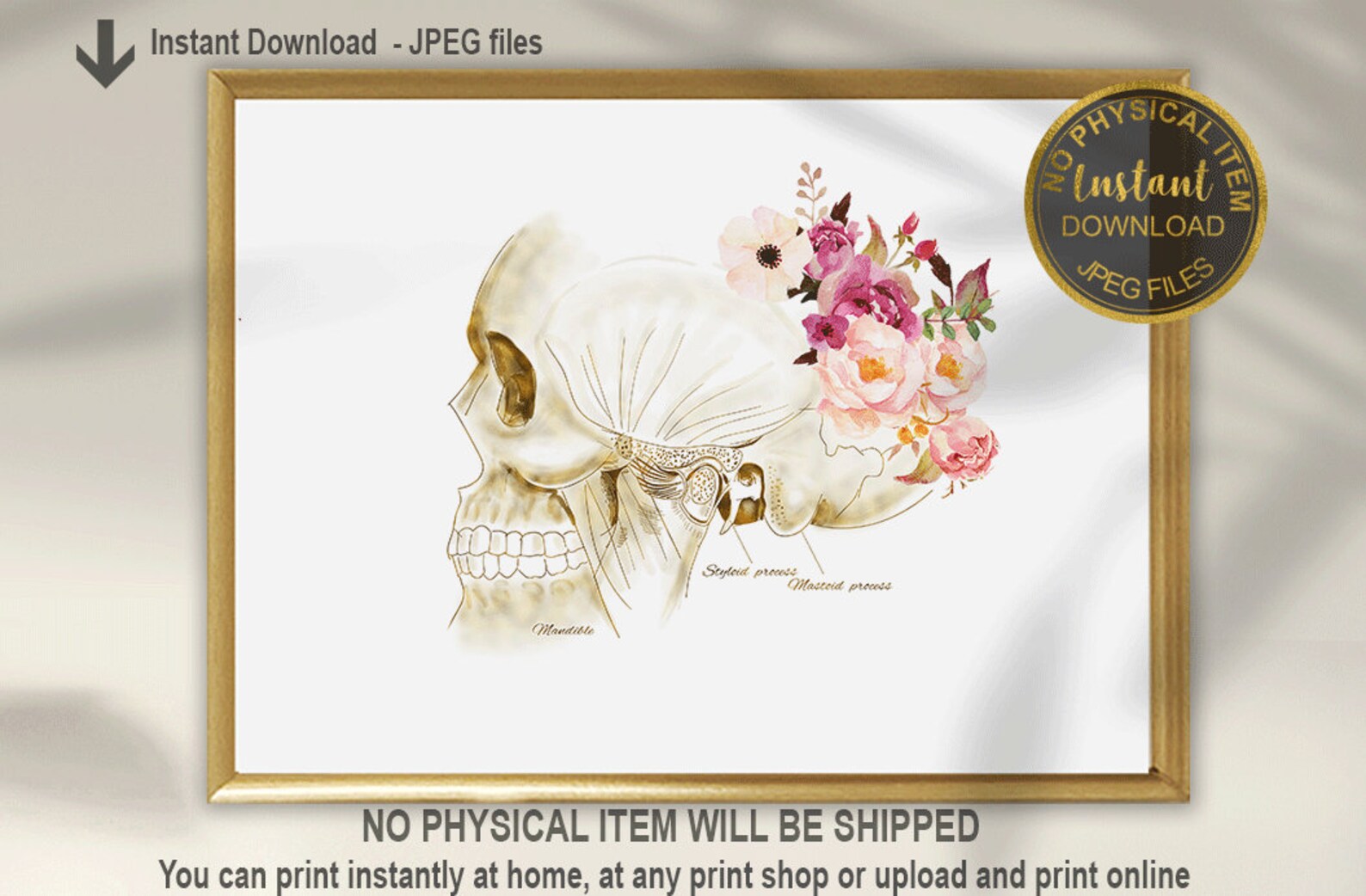 Temporomandibular Joint, TMJ Anatomy Art, Dental Art, Prosthodontist ...