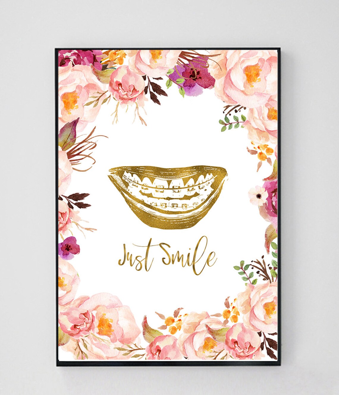 Smile Art Print, Smile Teeth Art, Dental Braces Print, Orthodontist ...