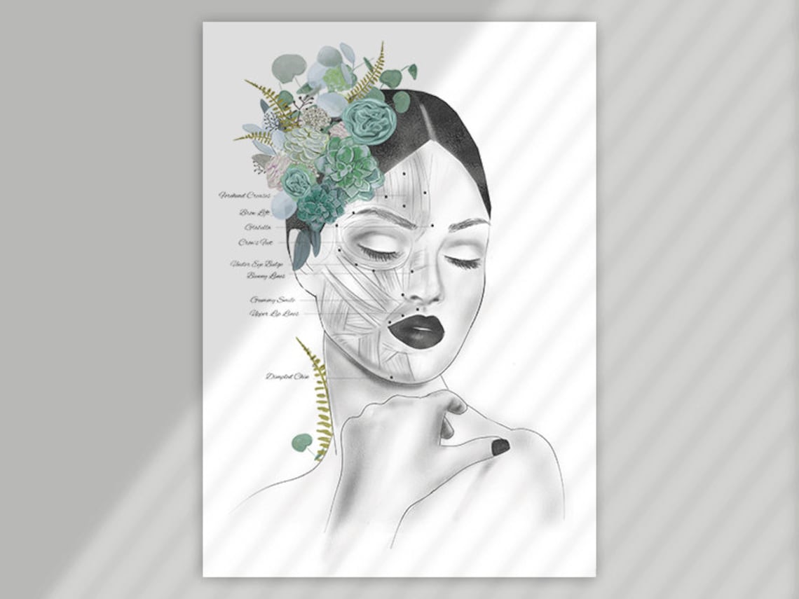 Botox Injection Points Art Esthetician Print Dermatology - Etsy