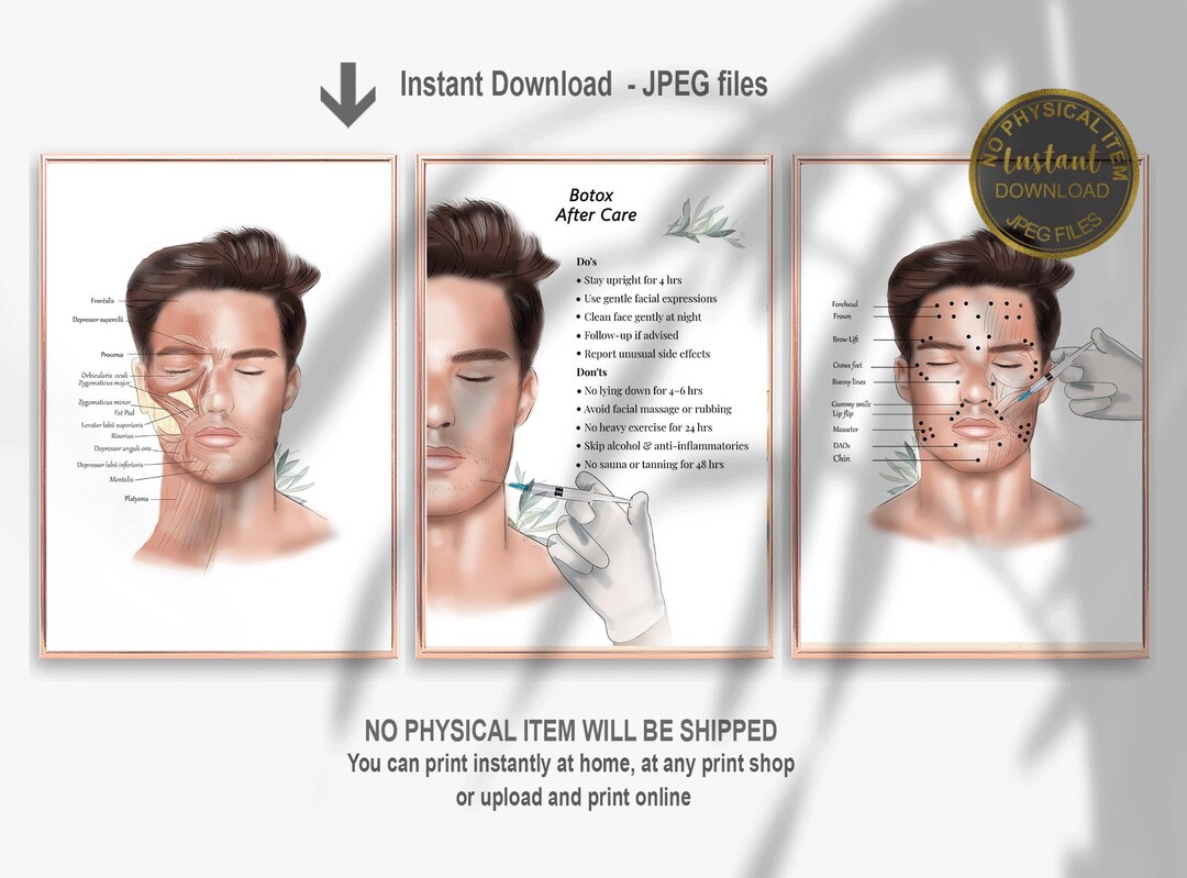 Botox Chart Printable Set | Male Facial Muscles Diagram | Aftercare ...