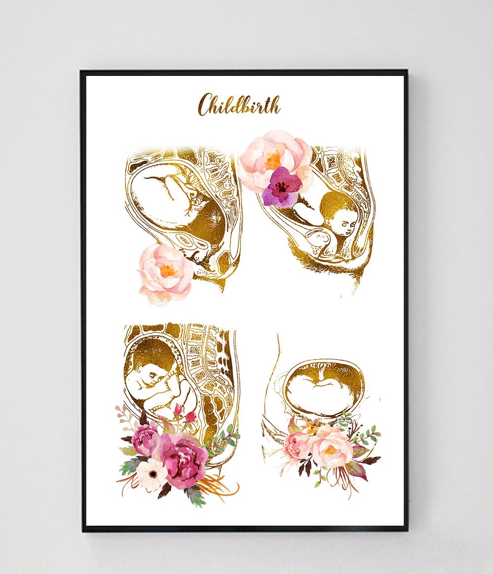 Midwife Print Printable Art Obgyn Art Print Midwife Office - Etsy UK