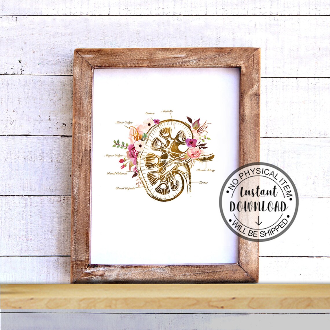 Kidney Print Urologist Office Decor Kidney Anatomy Art - Etsy