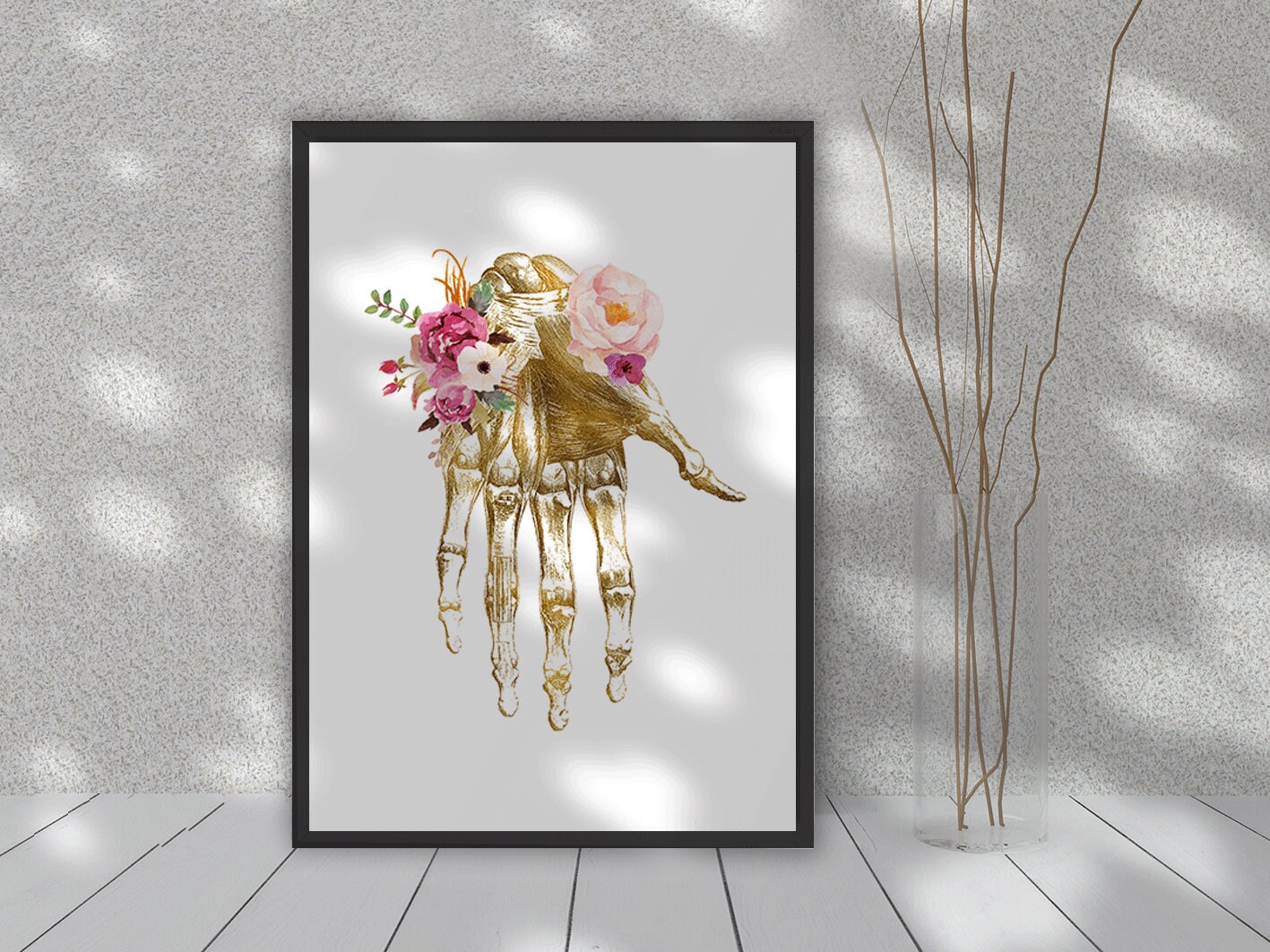 Human Hand Anatomy Poster Orthopedic Office Wall Art - Etsy