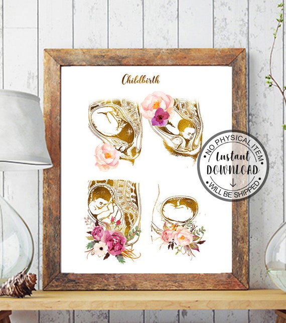 Midwife Print Printable Art Obgyn Art Print Midwife Office | Etsy