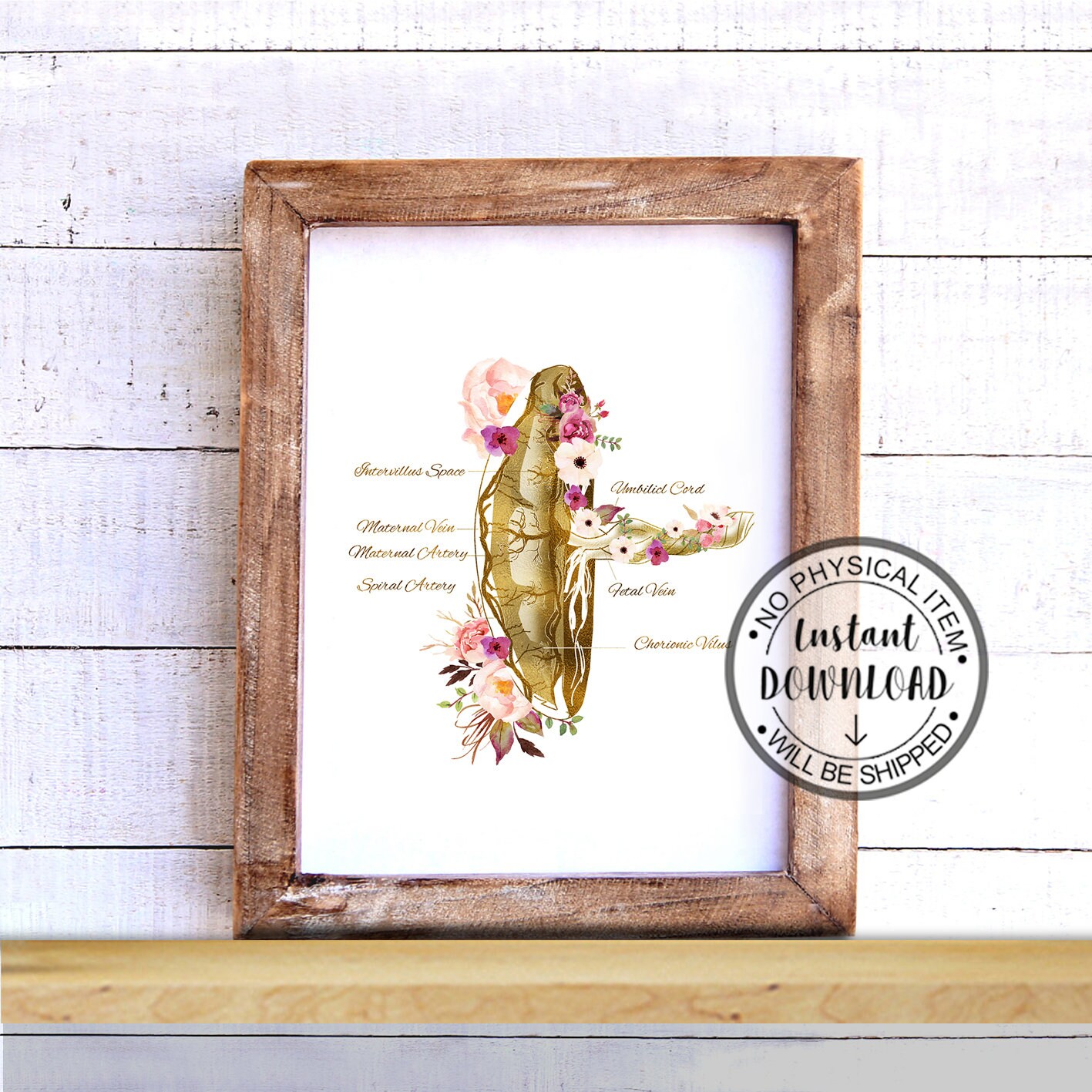Placenta Anatomy Art Fetal Placenta Obstetrician Gift | Etsy
