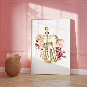 Root Canal Therapy Art, Endontic Therapy Print, Dentist Clinic Decor ...