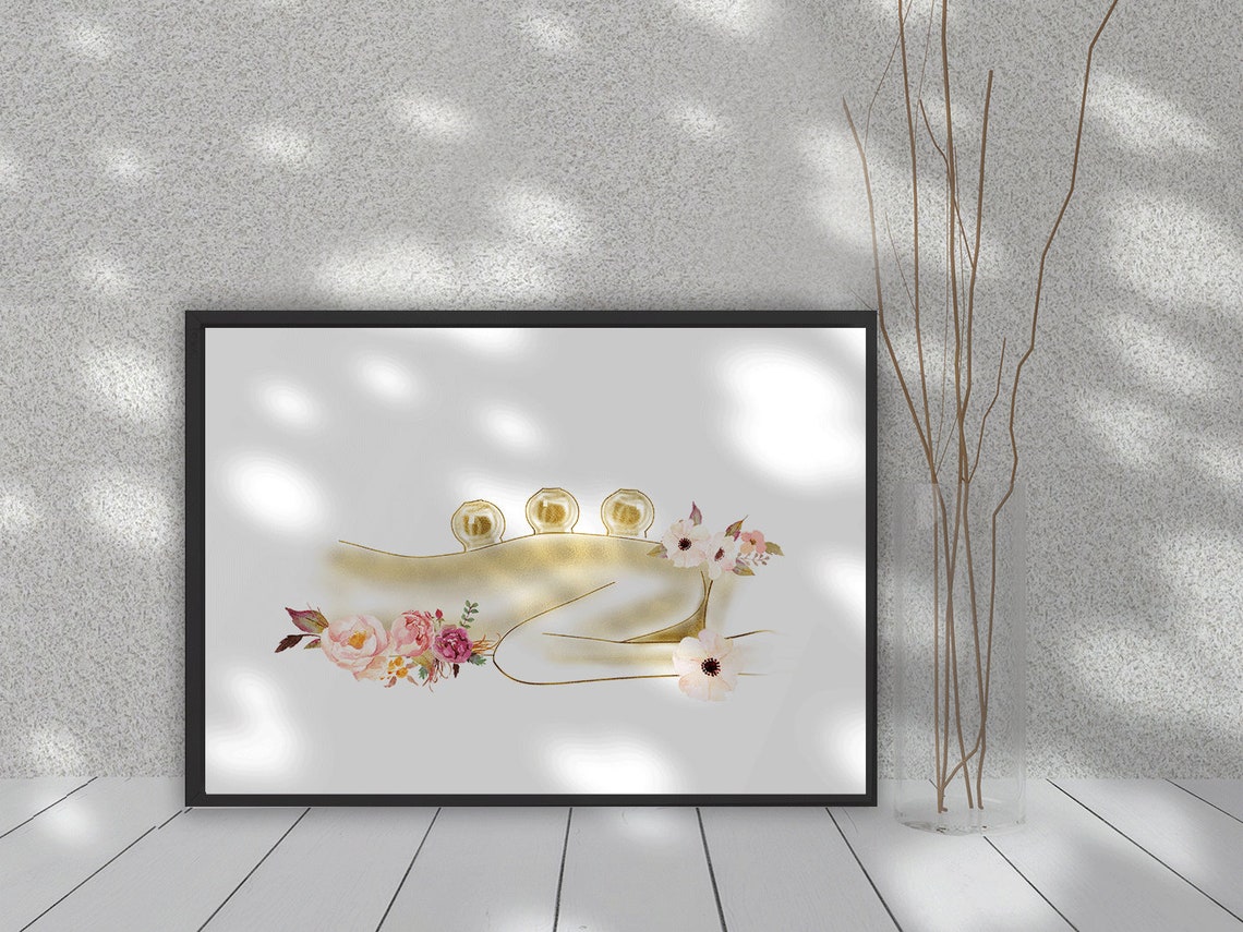 Cupping Therapy Art Print Cupping Therapist Gift Alternative - Etsy