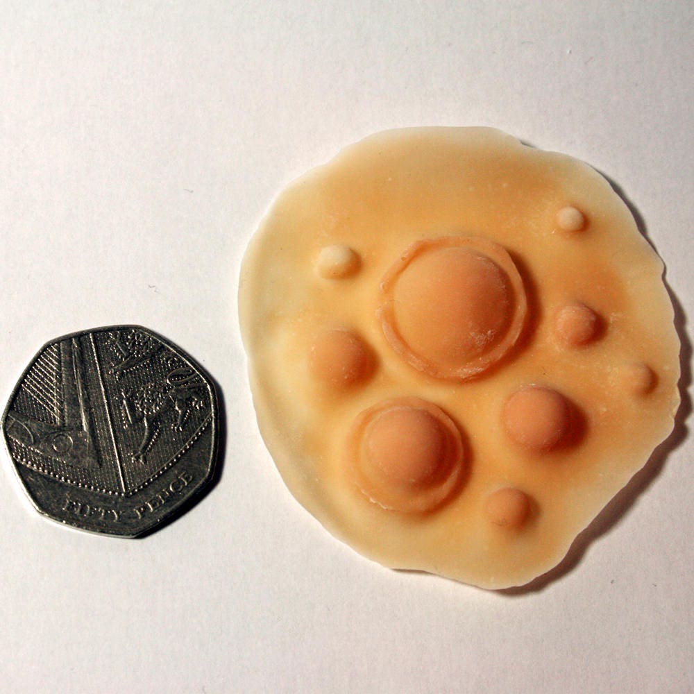 Boils 2 Disease Infection Plague Wound Deep & Detailed | Etsy