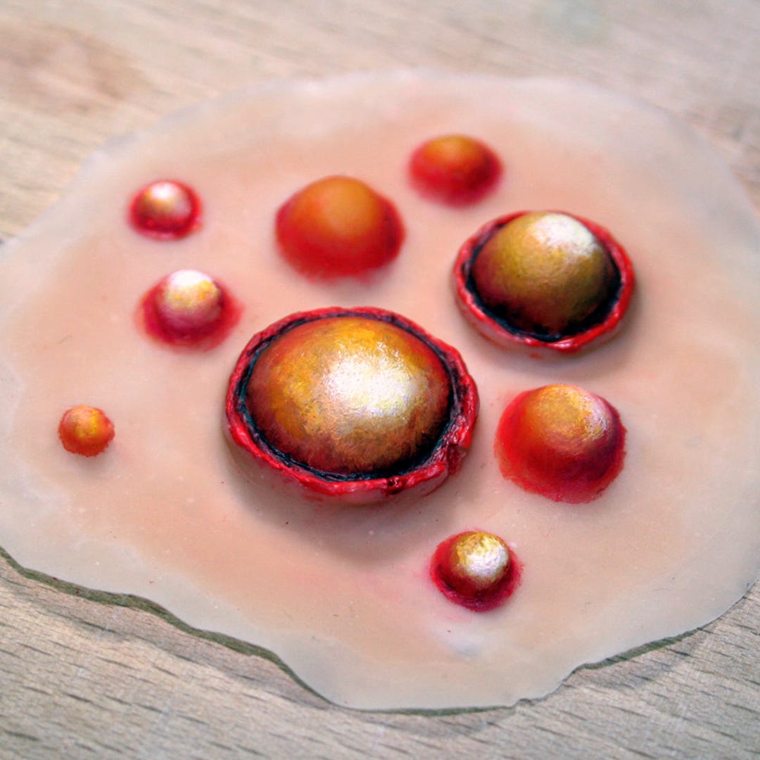 Boils #2 Disease Infection, Plague Wound! Deep & Detailed Latex ...