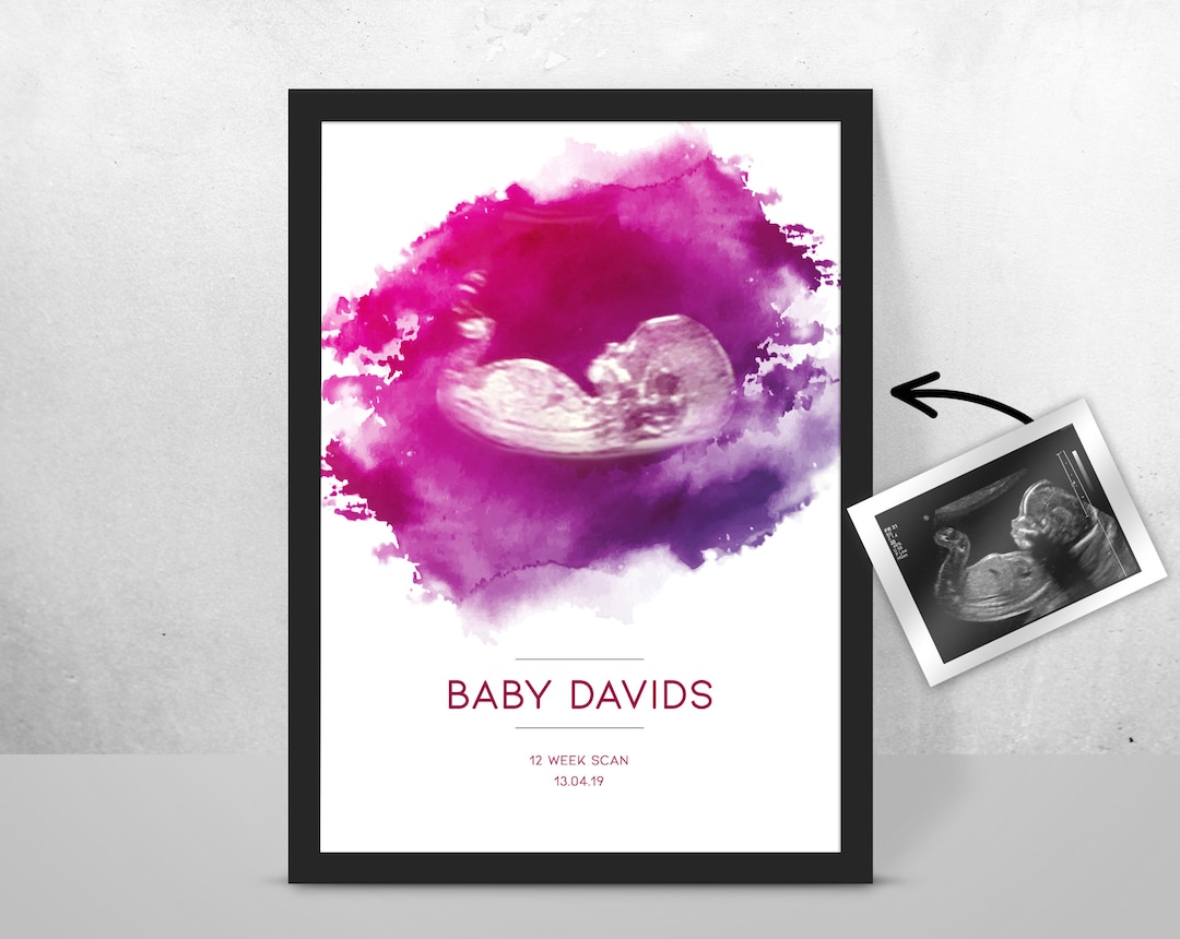 Personalised BABY Scan Ultrasound Watercolour Print 4D First Baby Scan ...