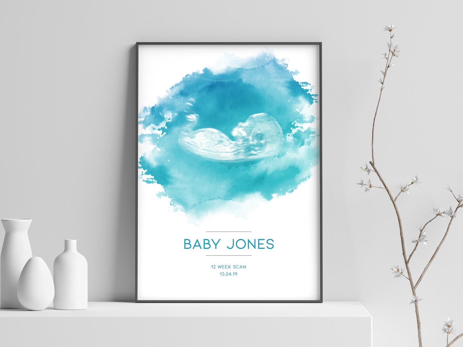 Personalised BABY Scan Ultrasound Watercolour Print 4D First - Etsy