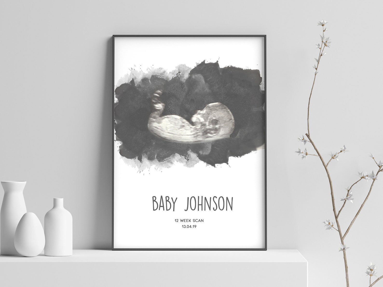 Personalised BABY Scan Ultrasound Watercolour Print 4D First - Etsy