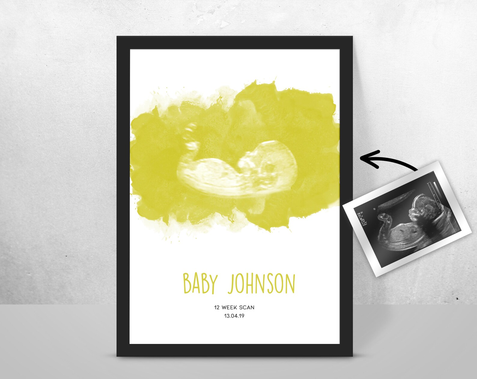 Personalised NEW BABY Scan Ultrasound Watercolour Print 4D | Etsy