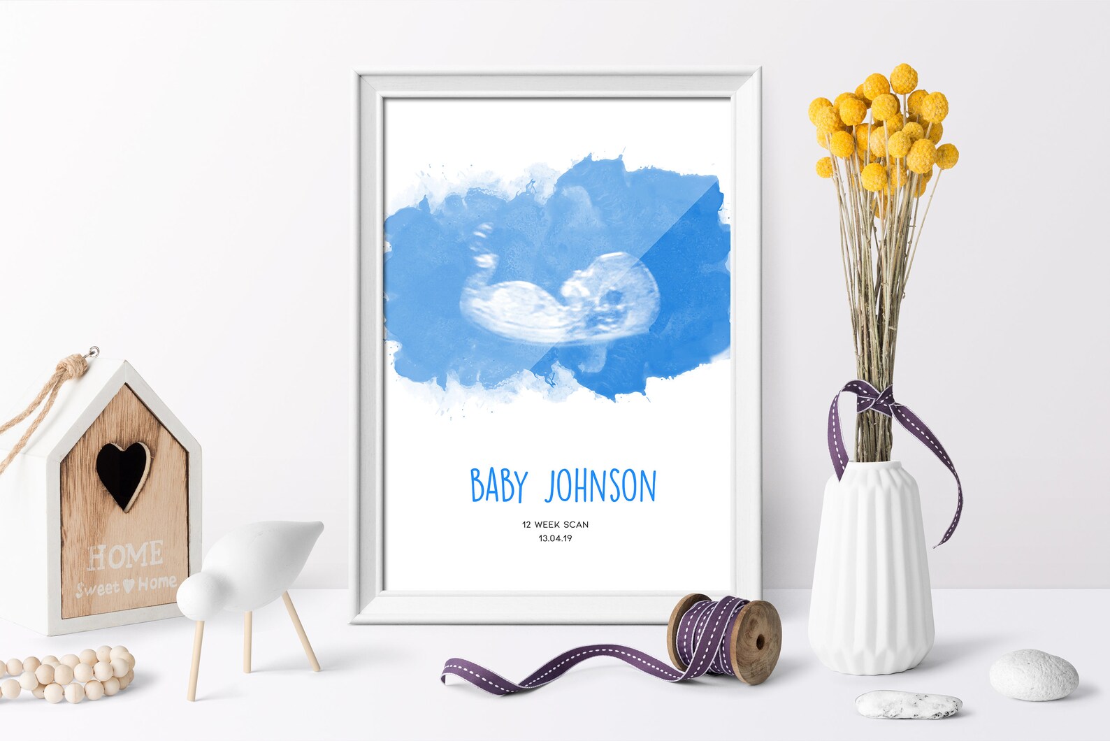 Personalised BABY Scan Ultrasound Watercolour Print 4D First Baby Scan ...