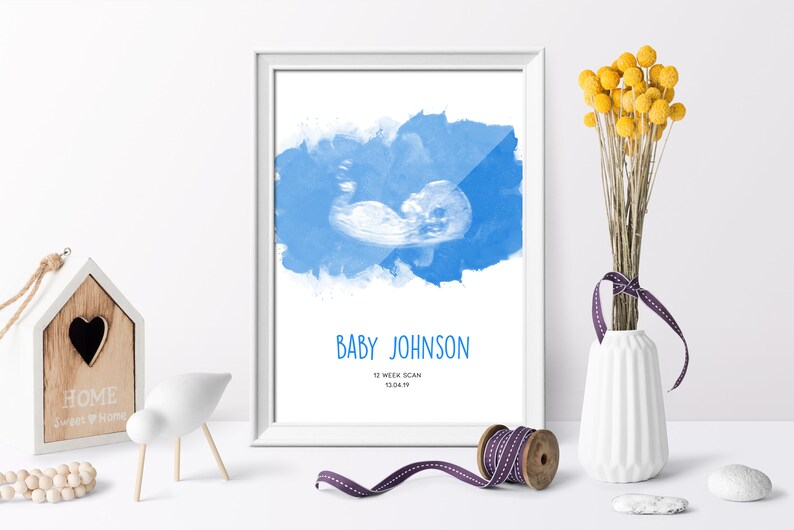 Personalised BABY Scan Ultrasound Watercolour Print 4D First Baby Scan ...