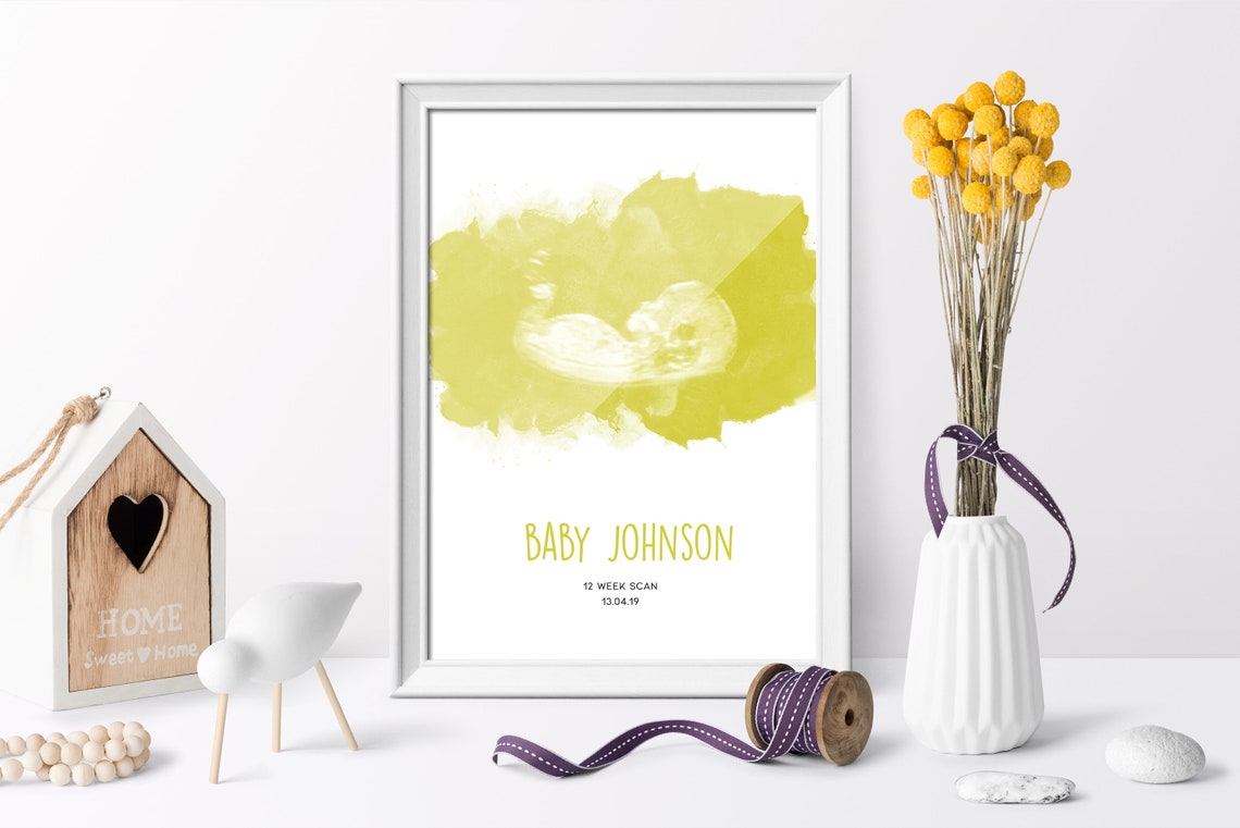 Personalised NEW BABY Scan Ultrasound Watercolour Print 4D First Baby ...