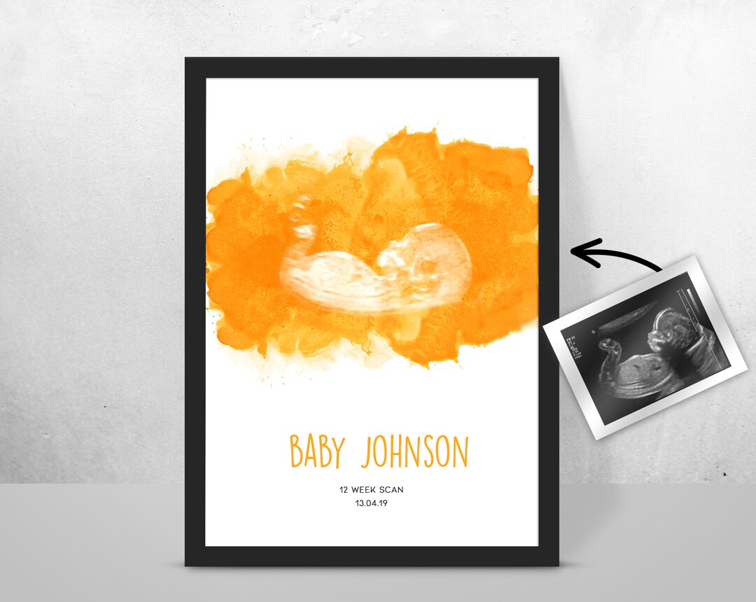 Personalised BABY Scan Ultrasound Watercolour Print 4D First Baby Scan ...