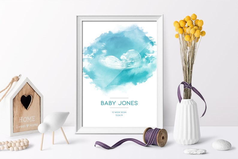 Personalised BABY Scan Ultrasound Watercolour Print 4D First - Etsy