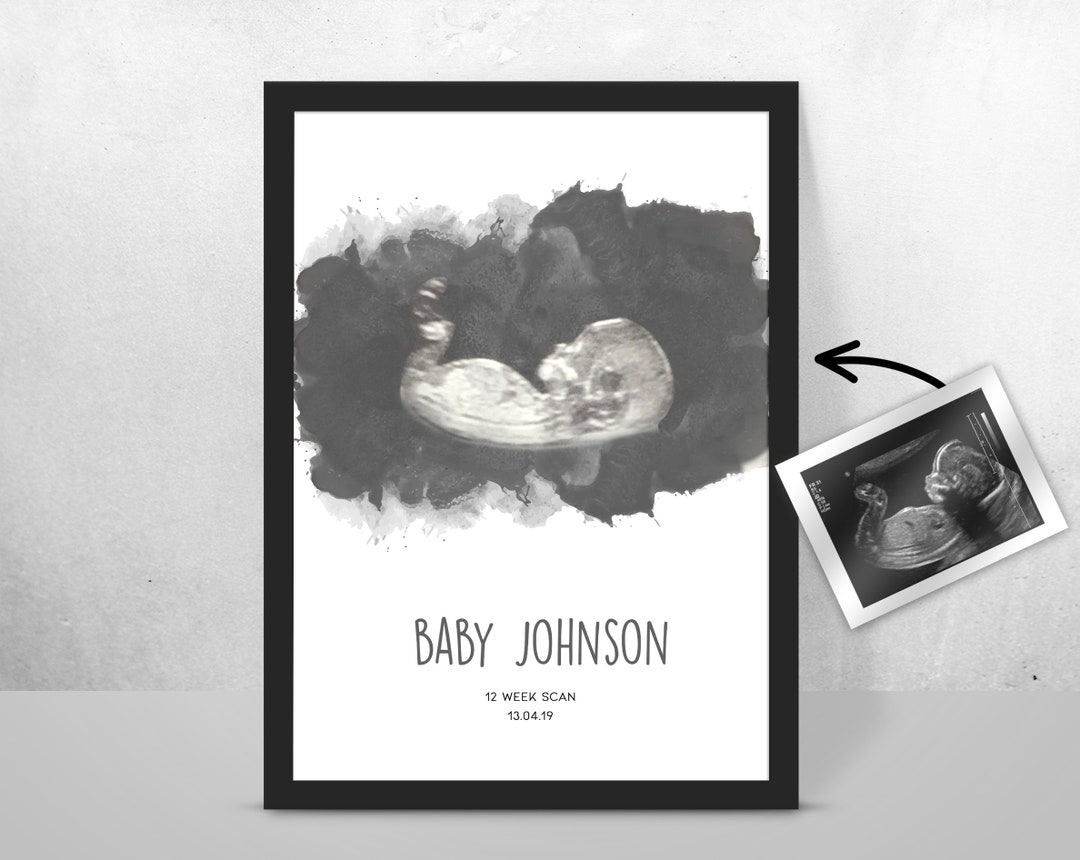 Personalised BABY Scan Ultrasound Watercolour Print 4D First Baby Scan ...