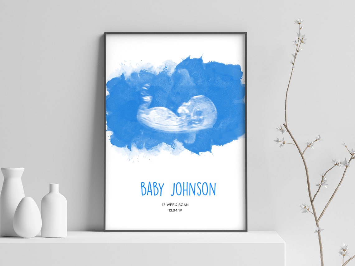 Personalised BABY Scan Ultrasound Watercolour Print 4D First Baby Scan ...