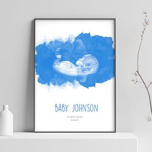 Personalised BABY Scan Ultrasound Watercolour Print 4D First Baby Scan ...