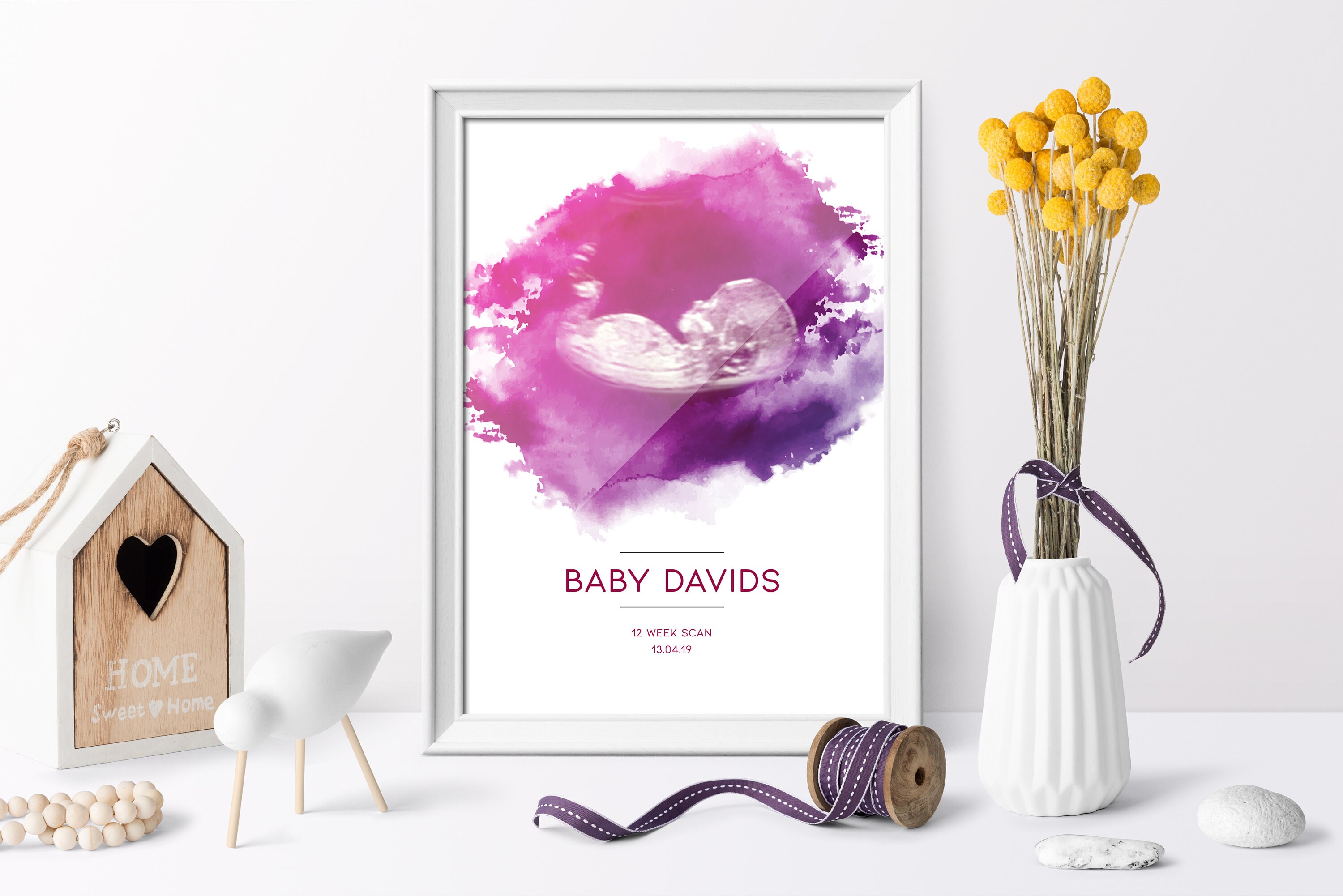 Personalised BABY Scan Ultrasound Watercolour Print 4D First - Etsy