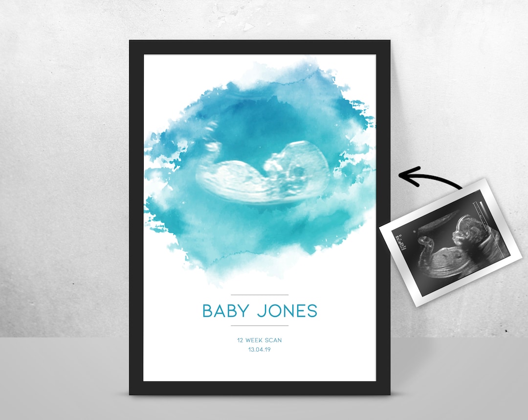 Personalised BABY Scan Ultrasound Watercolour Print 4D First Baby Scan ...