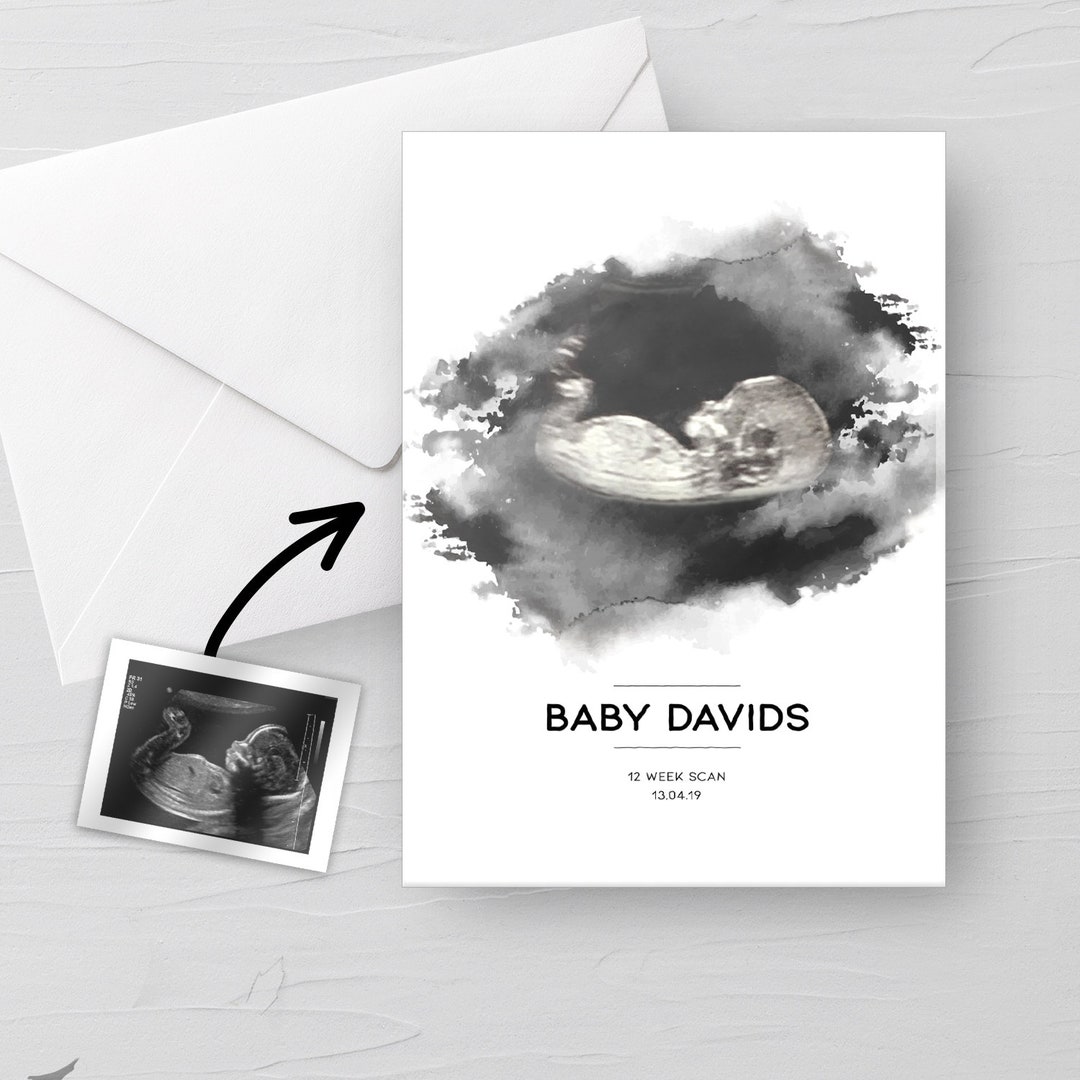 Personalised BABY Scan Ultrasound Watercolour Greeting Card 4D First ...