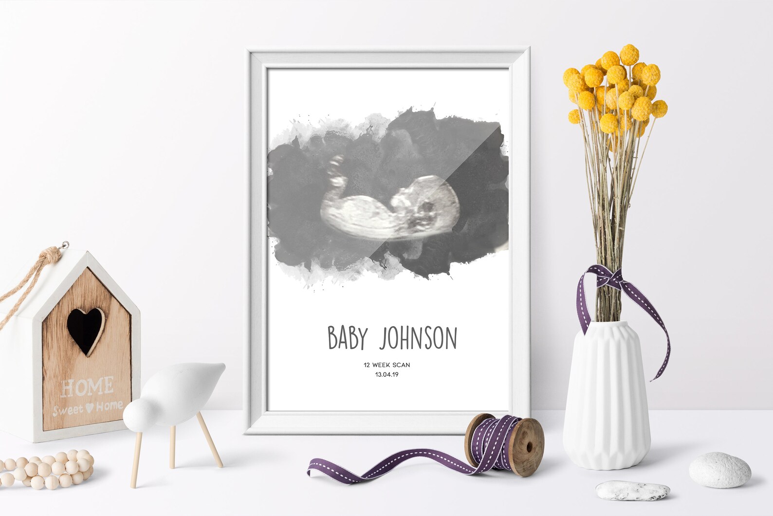 Personalised BABY Scan Ultrasound Watercolour Print 4D First - Etsy