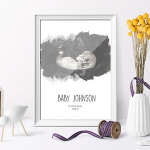 Personalised BABY Scan Ultrasound Watercolour Print 4D First Baby Scan ...