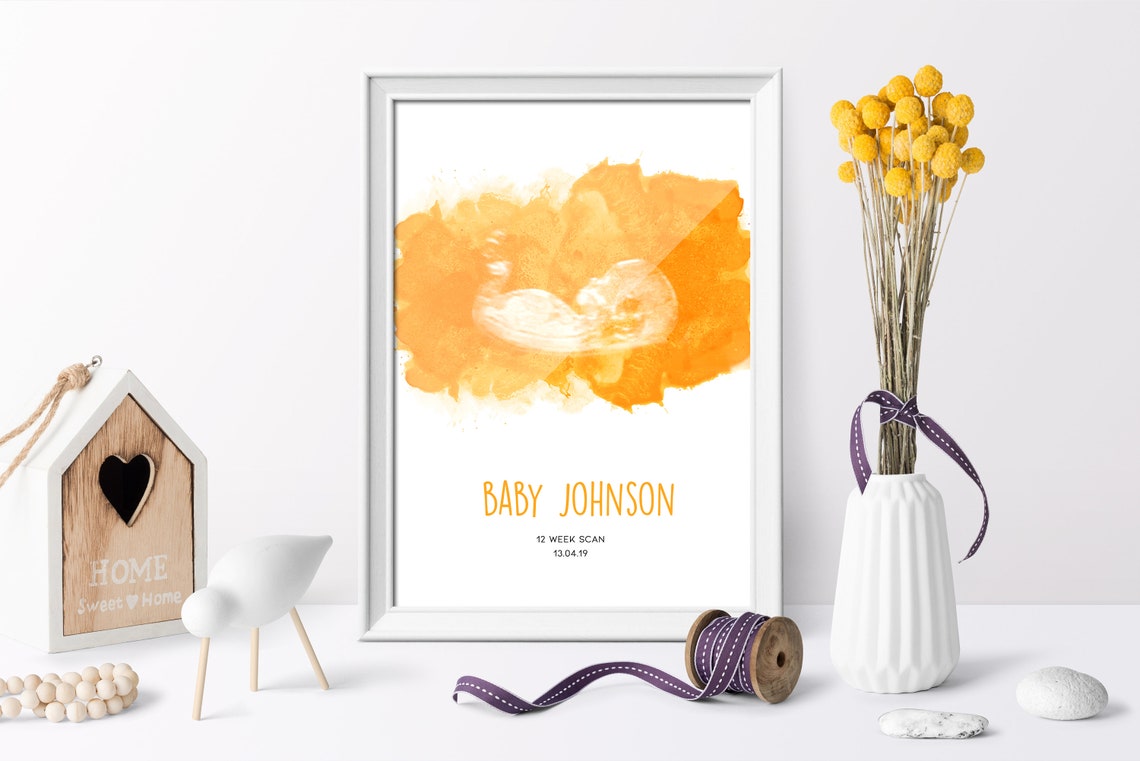 Personalised BABY Scan Ultrasound Watercolour Print 4D First Baby Scan ...
