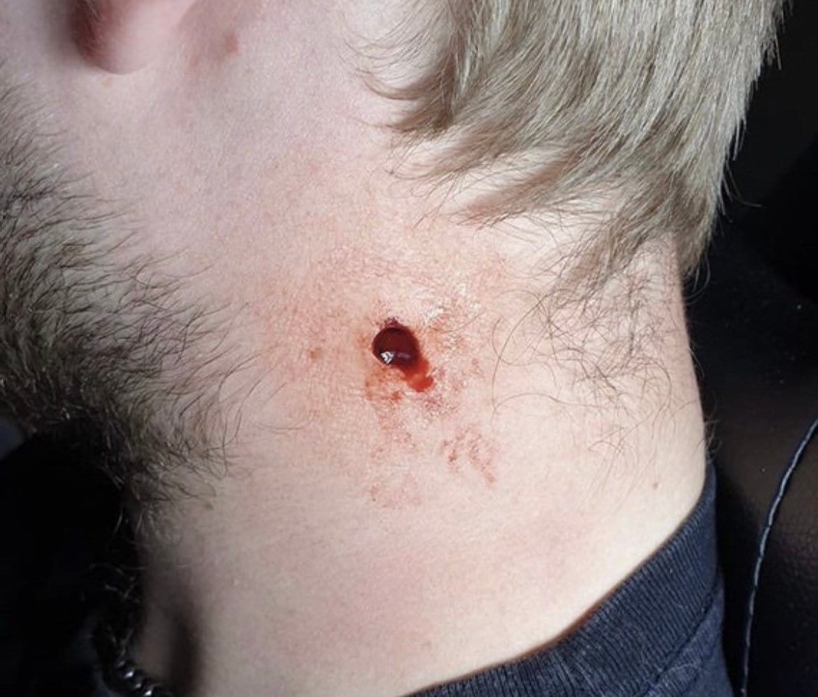 Entry Bullet Wound Gun Shot Prosthetic - Etsy