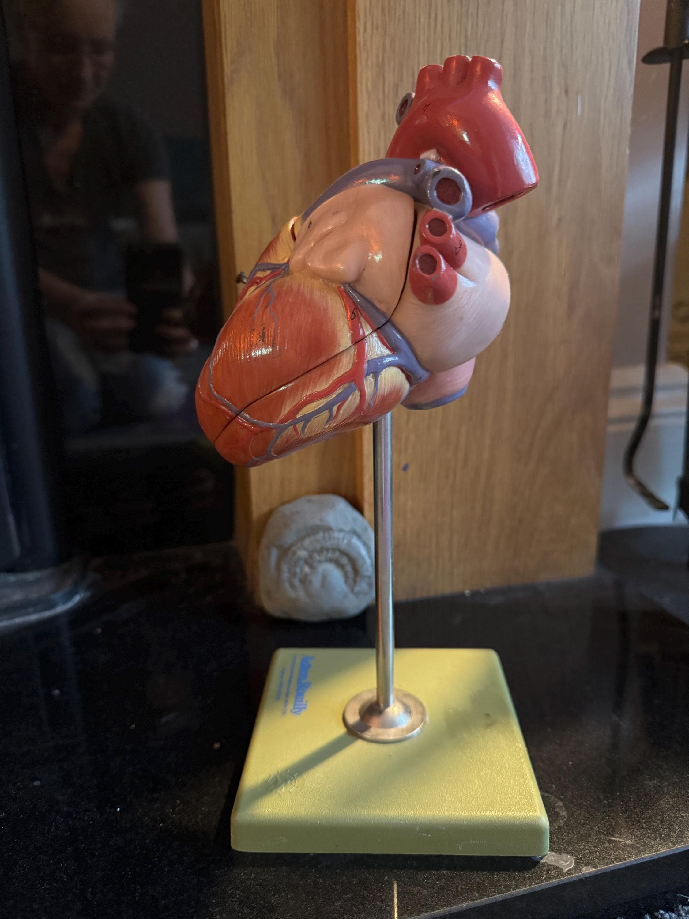 Vintage Somso Human Heart Anatomy Model: Educational Medical Display ...