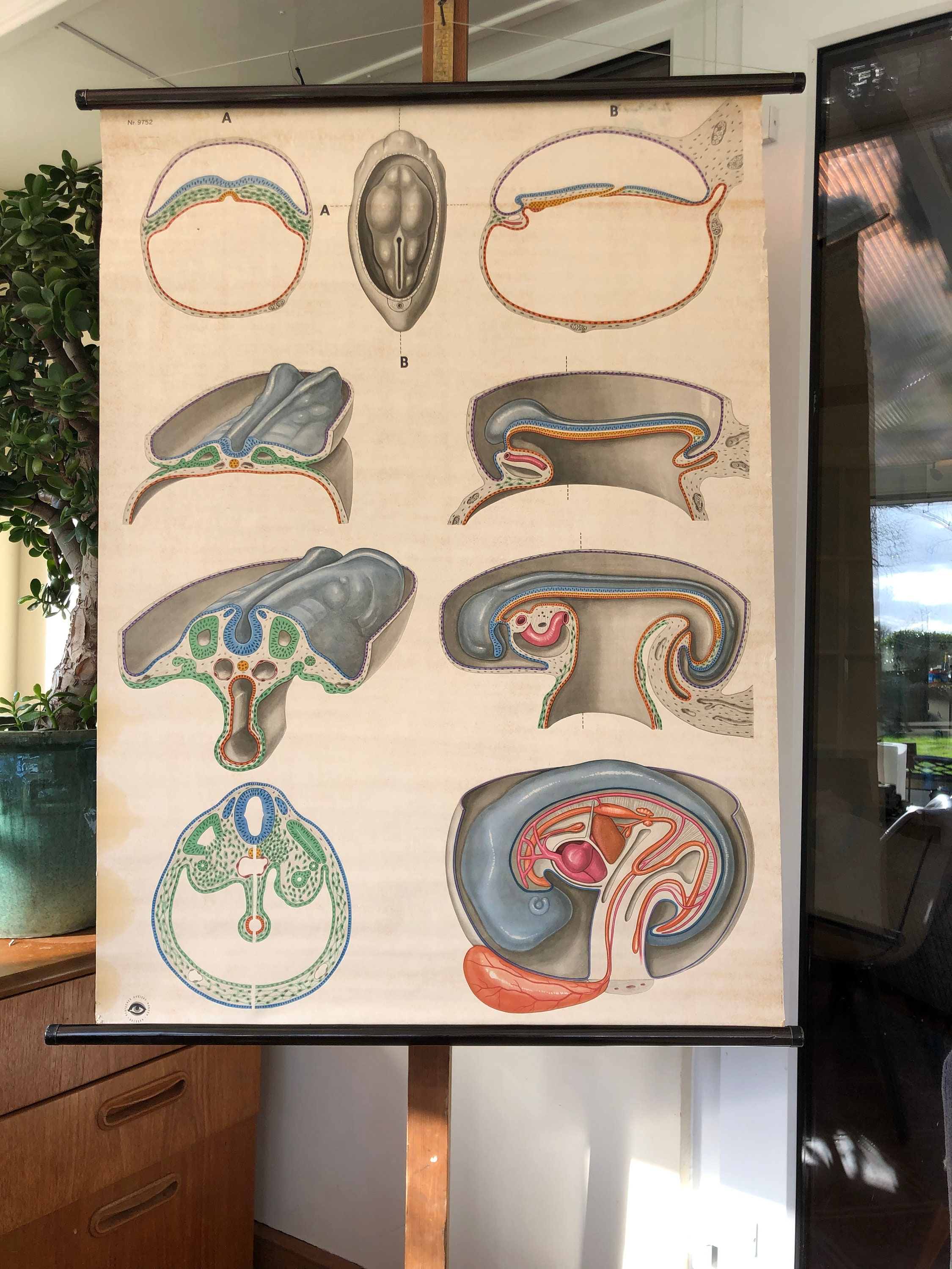 Vintage School Chart EMBRYOLOGY Midwifery Poster ANATOMY | Etsy