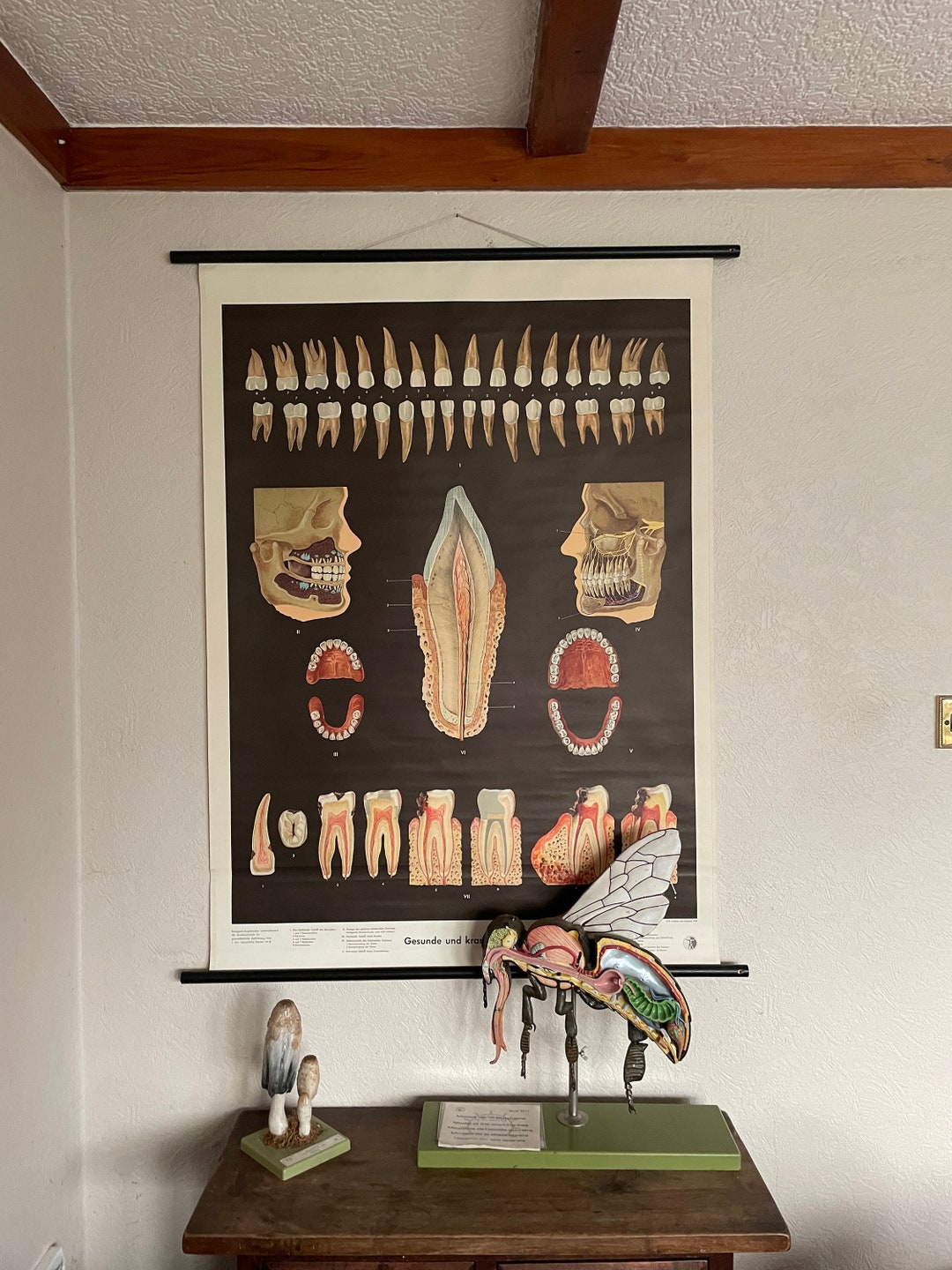 Vintage TEETH in HEALTH & DISEASE School Wall Chart Educational Medical ...