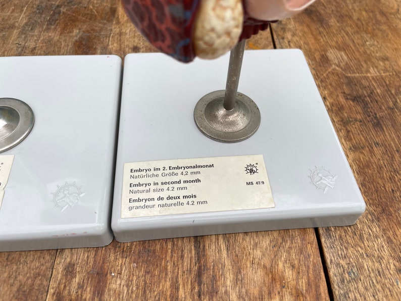 3 Vintage SOMSO Models of EMBRYO DEVELOPMENT in Pregnancy - Etsy UK