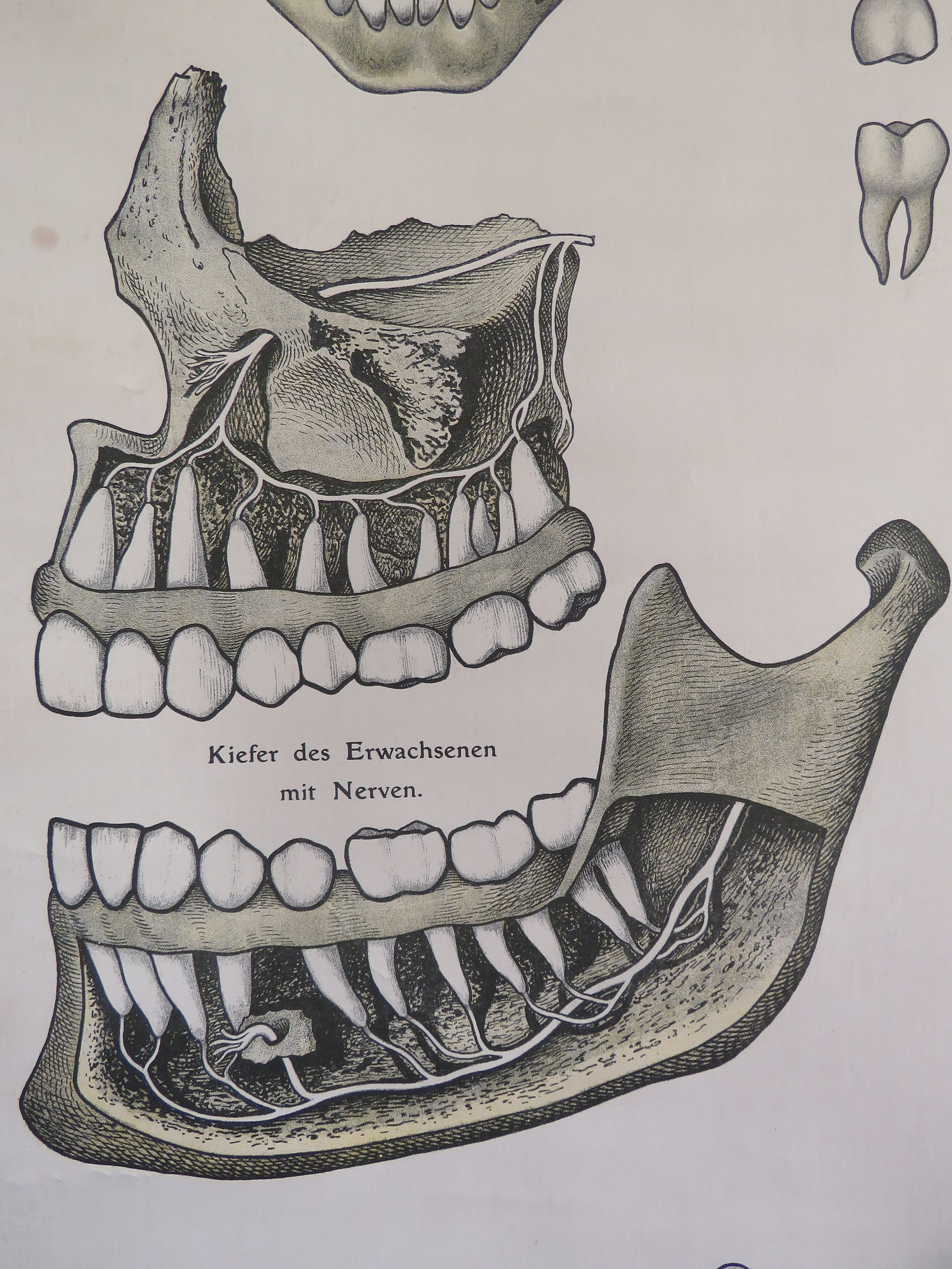 Rare Vintage Medical School Educational Chart of TEETH in | Etsy