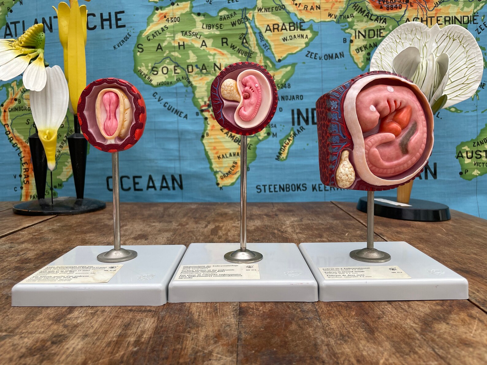 3 Vintage SOMSO Models of EMBRYO DEVELOPMENT in Pregnancy - Etsy UK