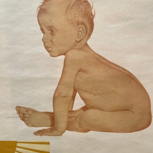 Vintage RICKETS and VITAMIN D Deficiency in Children Roll Down School ...